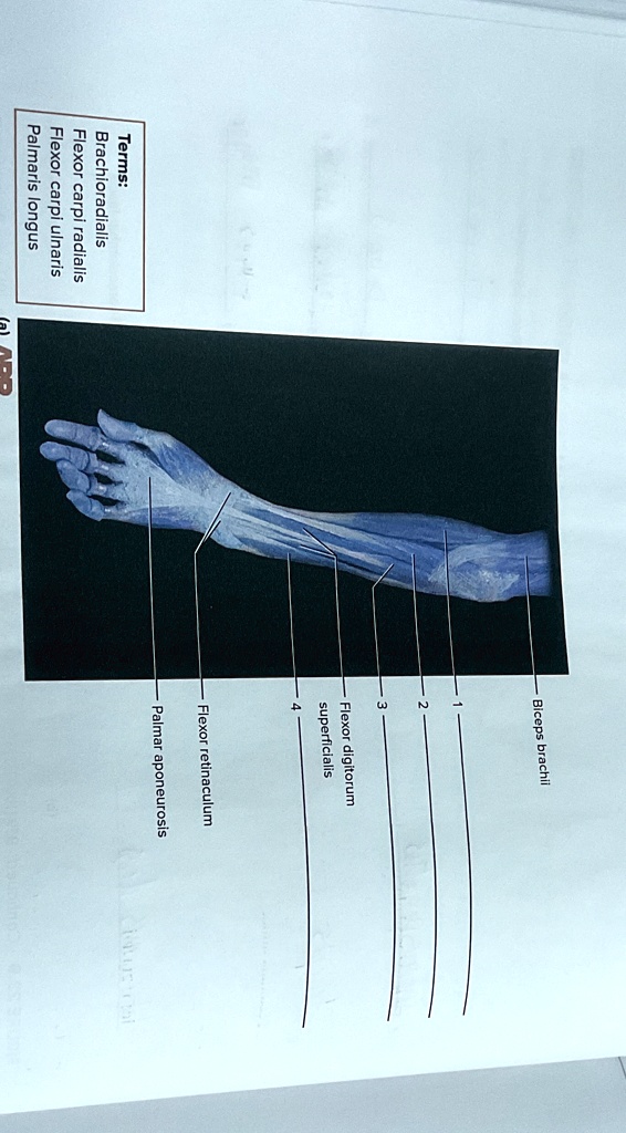 [GET ANSWER] Terms: Brachioradialis Flexor carpi radialis Flexor carpi ...