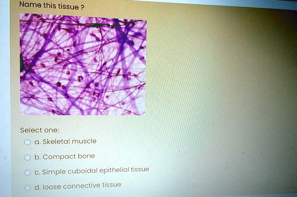 SOLVED: Name this tissue ? Select one: a. Skeletal muscle b. Compact ...