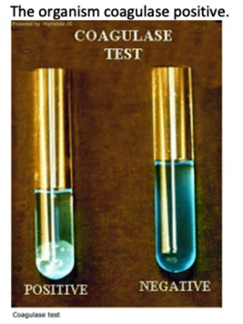 SOLVED: The organism coagulase positive: COAGULASE TEST POSITIVE NEGATIVE