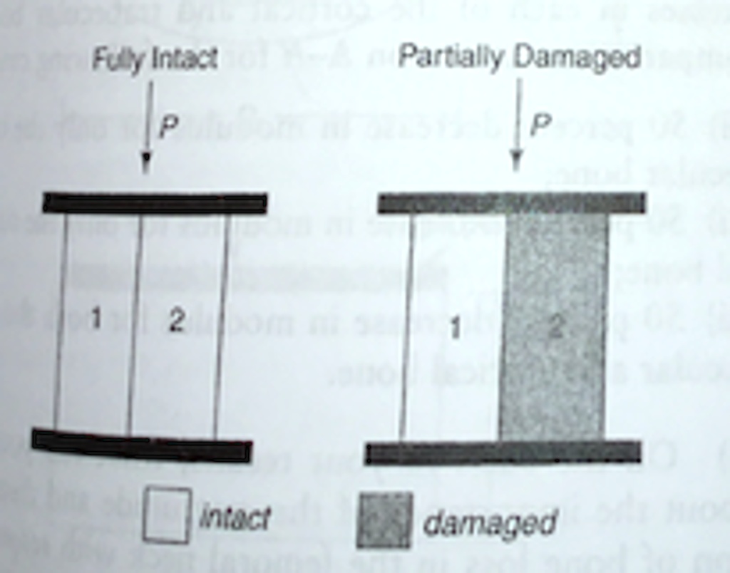 SOLVED: Consider an idealized vertebral body, as shown in the figure ...