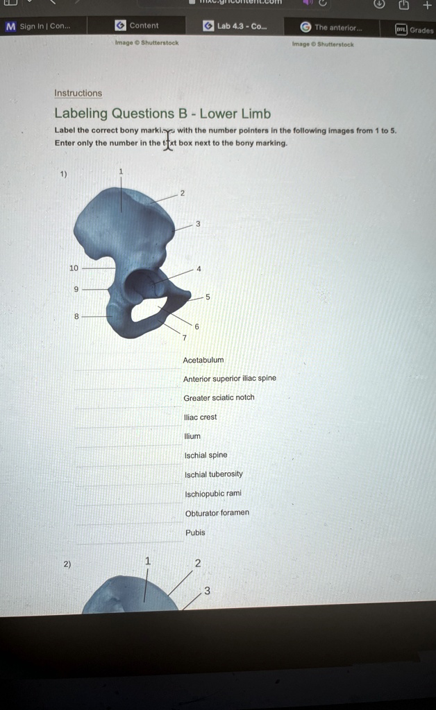 instructions labeling questions b lower limb label the correct bony ...