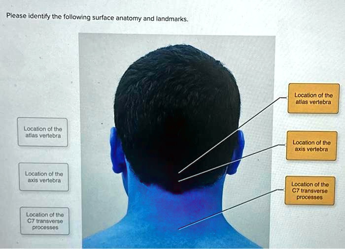 SOLVED: Please identify the following surface anatomy and landmarks ...