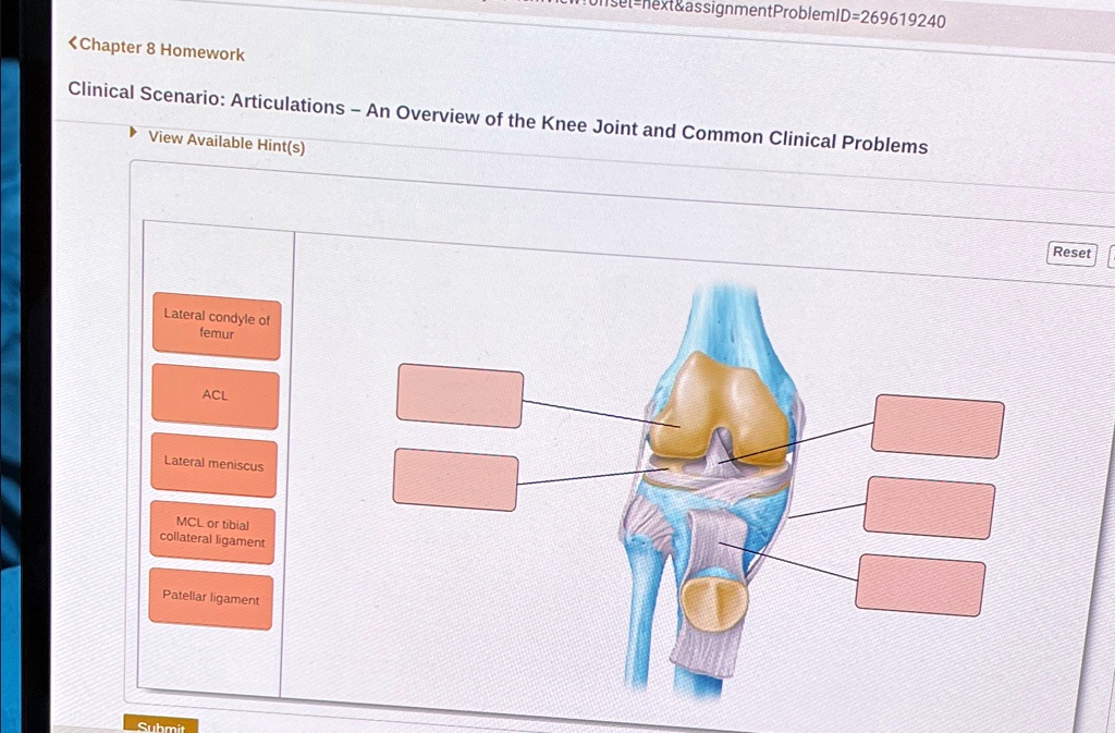 Overview of knee joint and common clinical problems Chapter 8 Homework ...