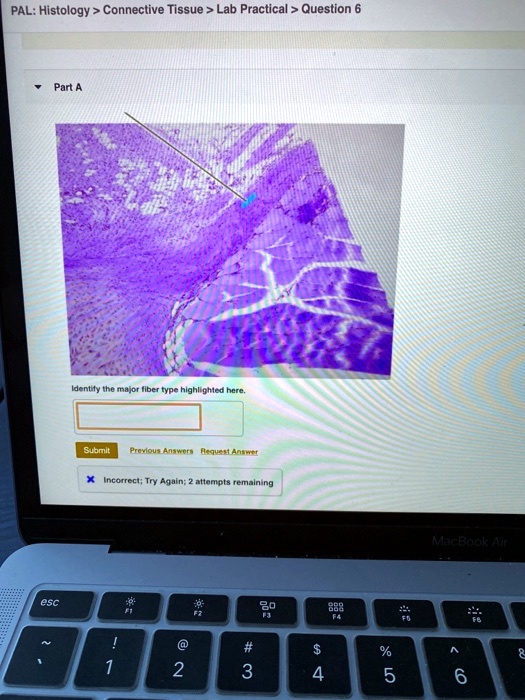 PAL: Histology > Connective Tissue > Lab Practical > Question 6 Part A Identify the major fiber ...