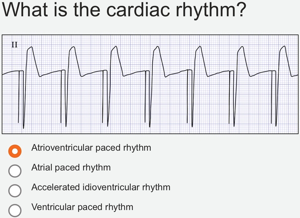 what is the cardiac rhythm shown in the strip below choose from the ...