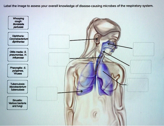 [GET ANSWER] Label the image to assess your overall knowledge of ...