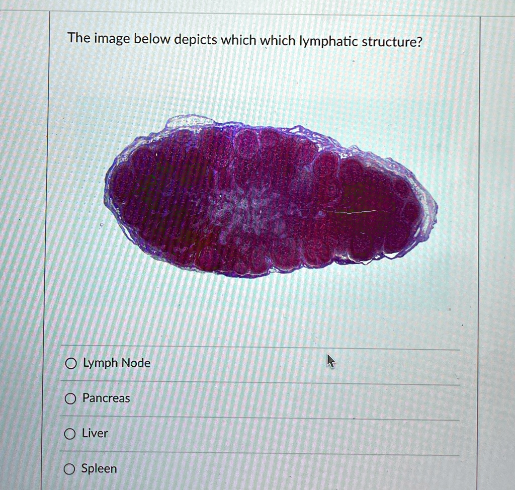 the image below depicts which which lymphatic structure lymph node ...