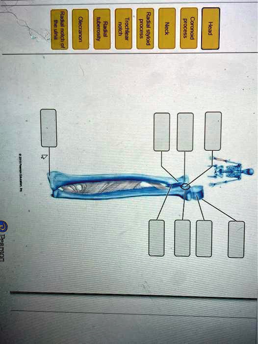 SOLVED: The ulna Radial notch of Olecranon tuberosity Radial notch ...