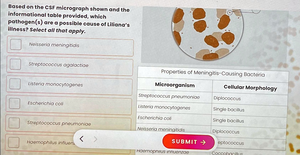 Based on the CSF micrograph shown and the informational table provided ...