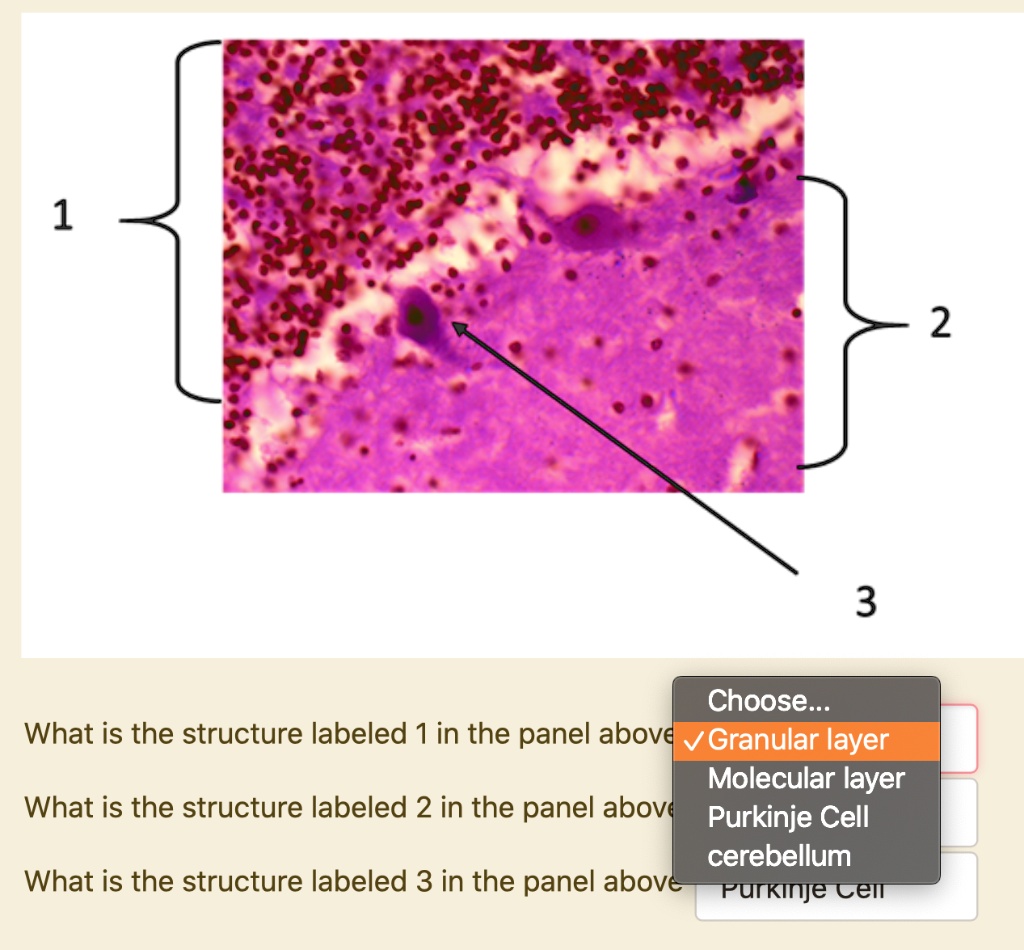 1 2 3 choose what is the structure labeled in the panel above granular ...