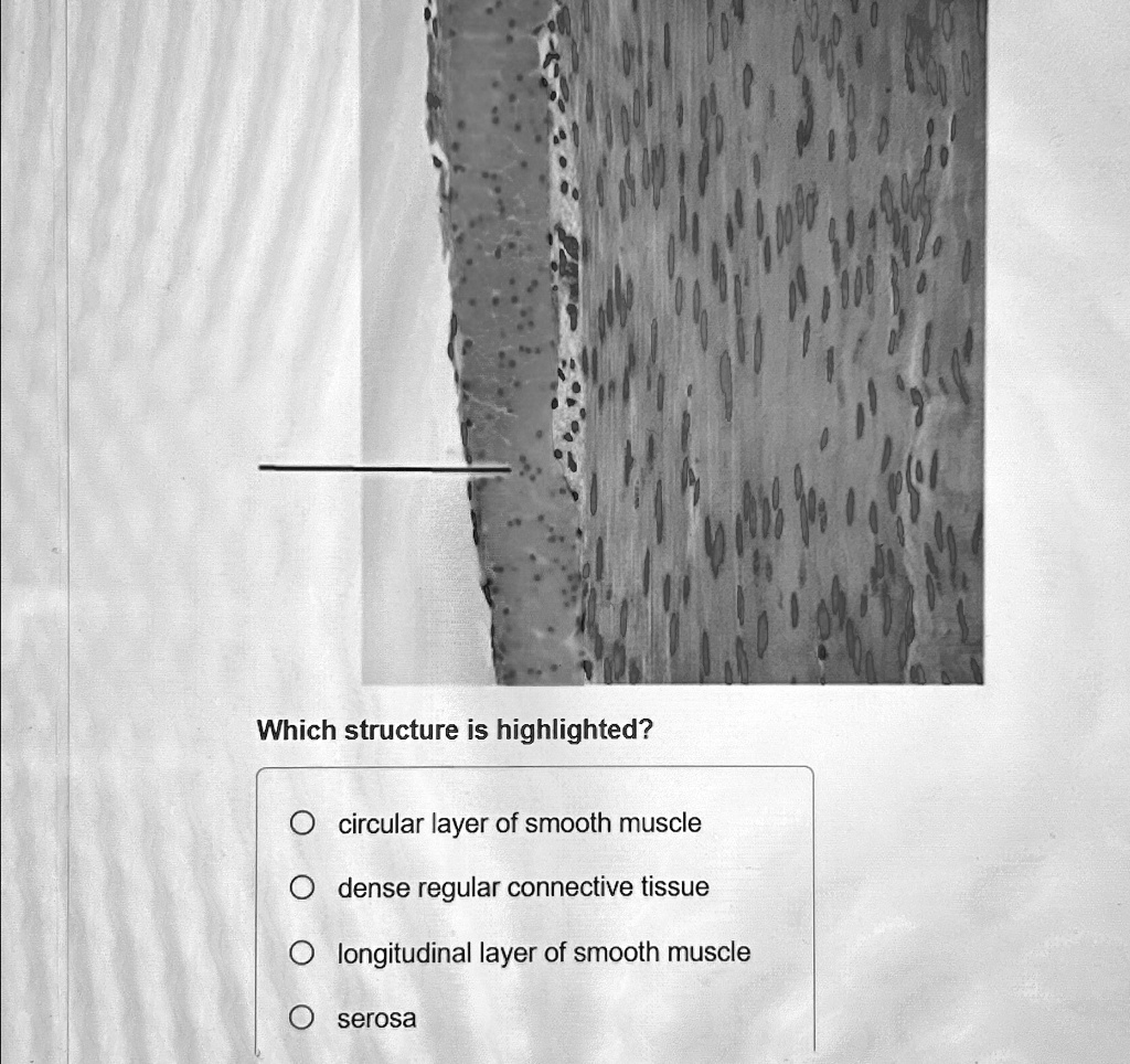Which structure is highlighted? circular layer of smooth muscle dense ...