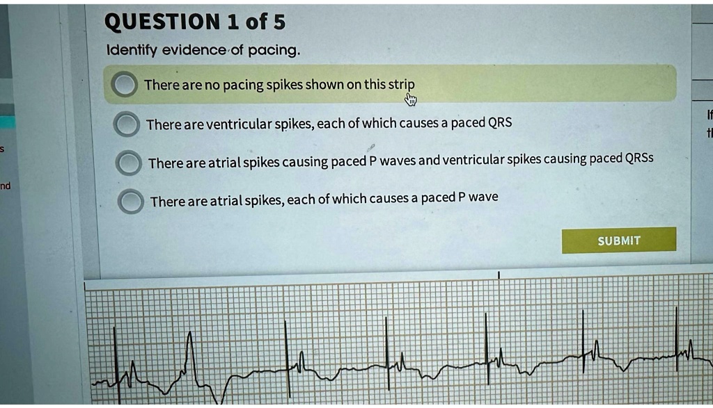 question 1 of 5 identify evidence of pacing there are no pacing spikes shown on this strip there ...