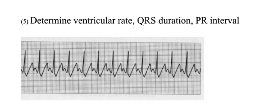 5 determine ventricular rate qrs duration pr interval wnn w 76752