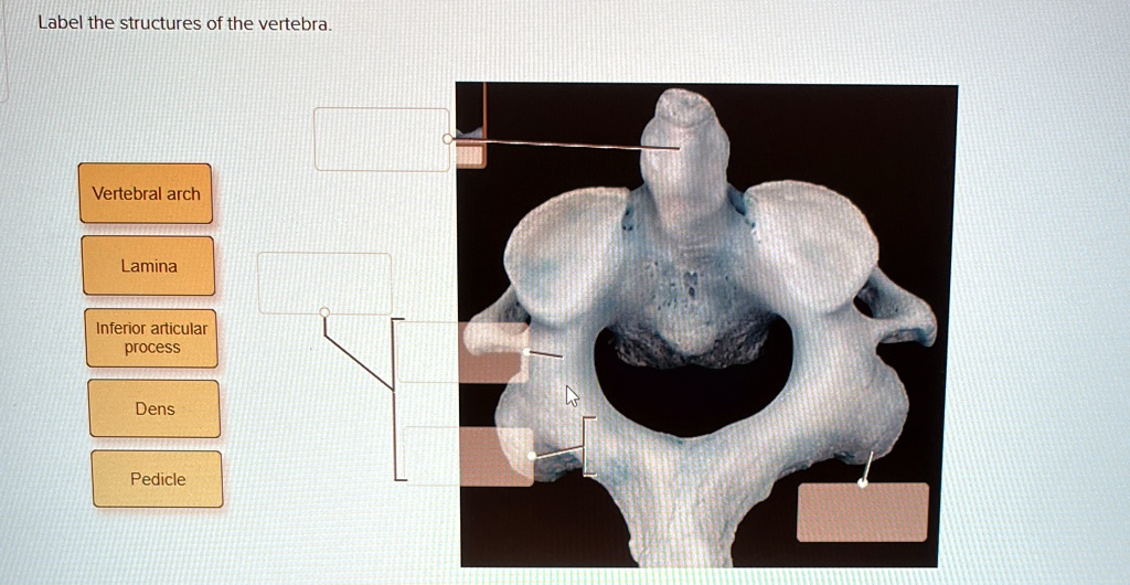 label the structures of the vertebra vertebral arch lamina inferior ...