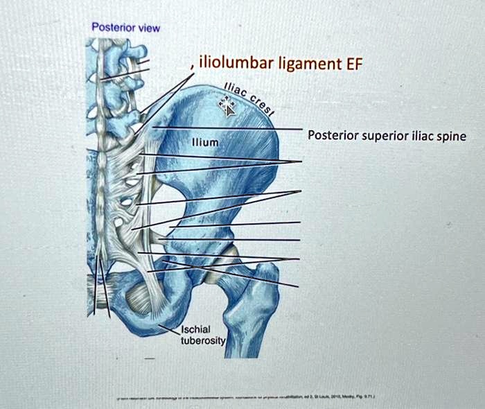 [GET ANSWER] Posterior view , iliolumbar ligament EF Iliac crest Ilium ...