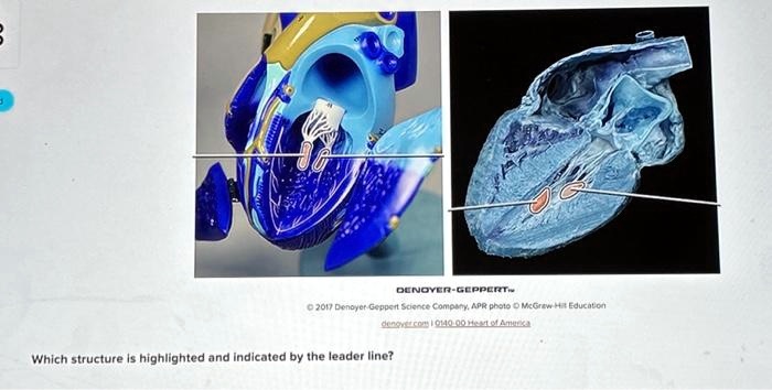 SOLVED: The structure highlighted and indicated by the leader line is ...