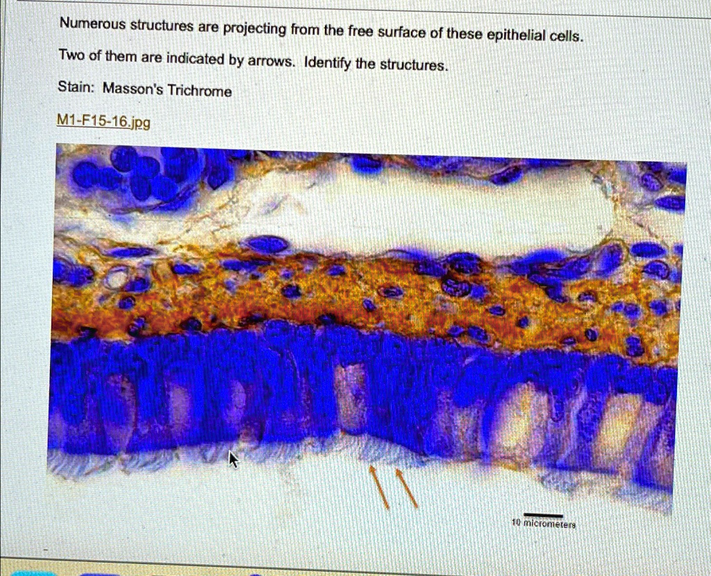 SOLVED: Numerous structures are projecting from the free surface of ...