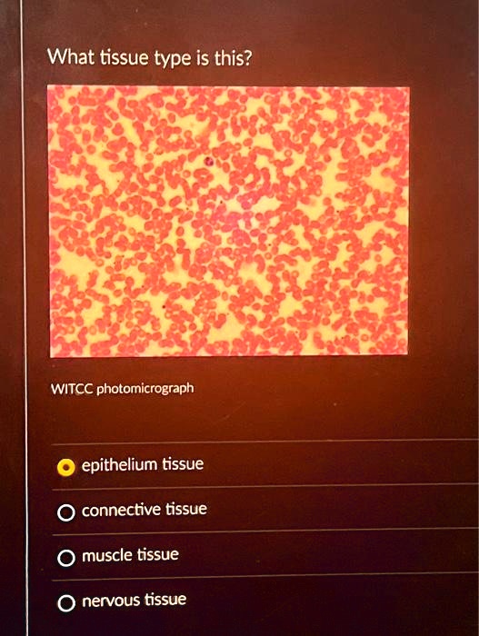 SOLVED: Texts: What tissue type is this? WITCC photomicrograph ... SOLVED: Texts: What tissue type is this? WITCC photomicrograph ...
