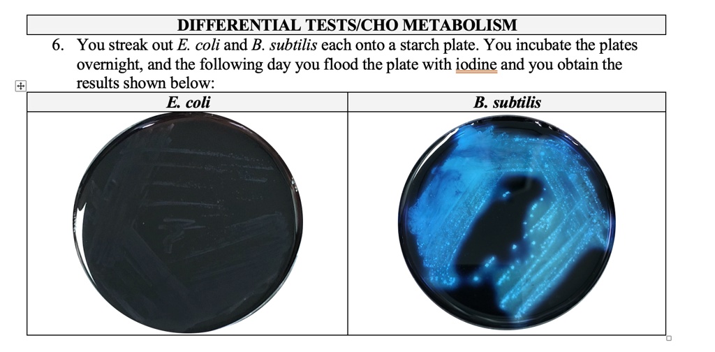 DIFFERENTIAL TESTS/CHO METABOLISM 6. You streak out E. coli and B ...