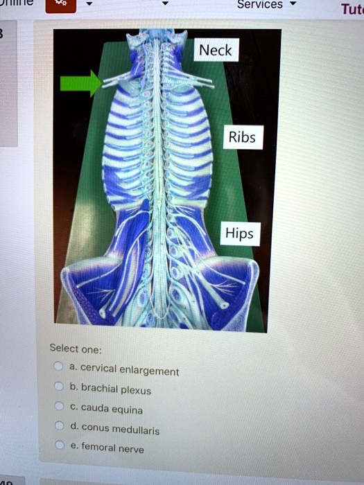 SOLVED: Services Tutoring Neck Ribs Hips Select one: cervical ...