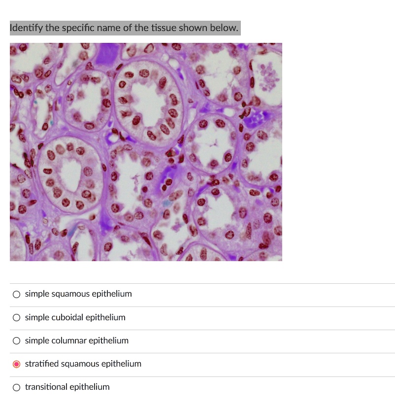 SOLVED: Identify the specific name of the tissue shown below.Identify the specific name of the ...