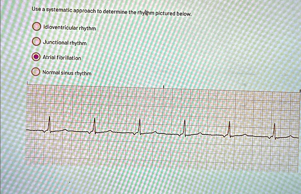 use a systematic approach to determine the rhythm pictured below ...