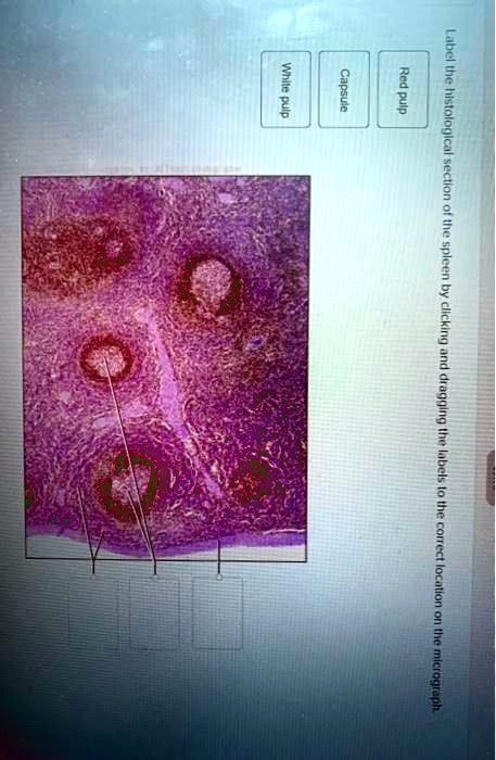 Label the histological section of the spleen by clicking and dragging ...
