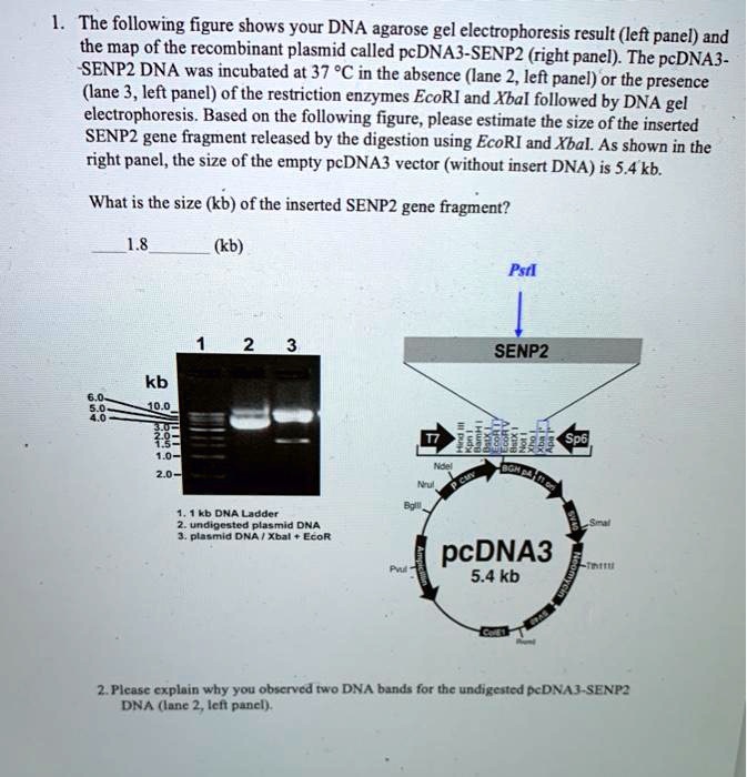 SOLVED: The following figure shows your DNA agarose gel electrophoresis ...
