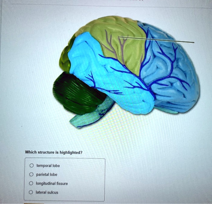 SOLVED: Which structure is highlighted? temporal lobe parietal lobe ...