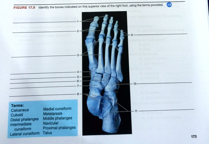 FIGURE 17.9 Identify the bones indicated on this superior view of the ...