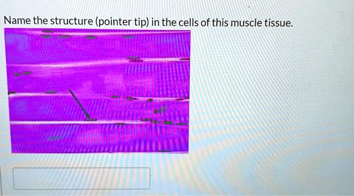 [GET ANSWER] name the structure pointer tip in the cells of this muscle ...