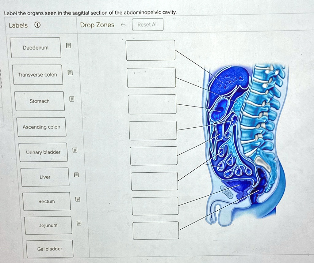 Label the organs seen in the sagittal section of the abdominopelvic ...