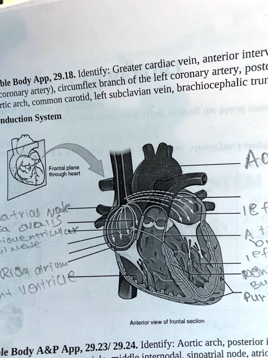 SOLVED: Cardiac vein; anterior interventricular septum. Identify: Greater posterior body apex of ...