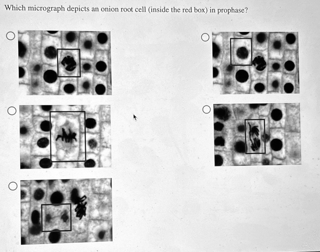 Which micrograph depicts an onion root cell (inside the red box) in ...