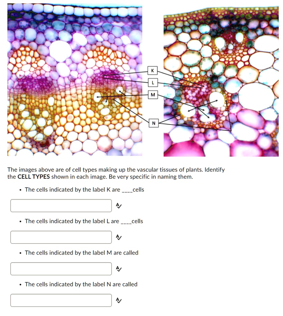 SOLVED: The images above are of cell types making up the vascular ...