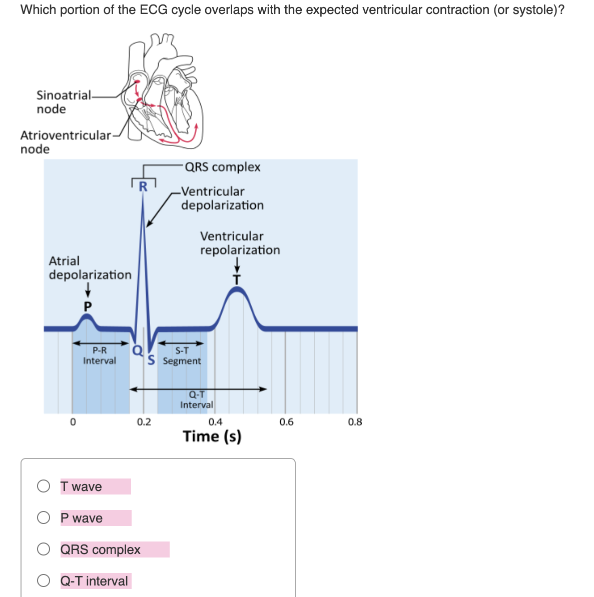 Which portion of the ECG cycle overlaps with the expected ventricular ...