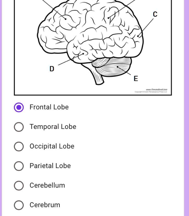 SOLVED: 'Which part of the brain is made of all four lobes? (Parts A, B ...