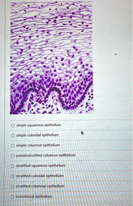 SOLVED: Simple squamous epithelium Simple cuboidal epithelium Simple columnar epithelium ...