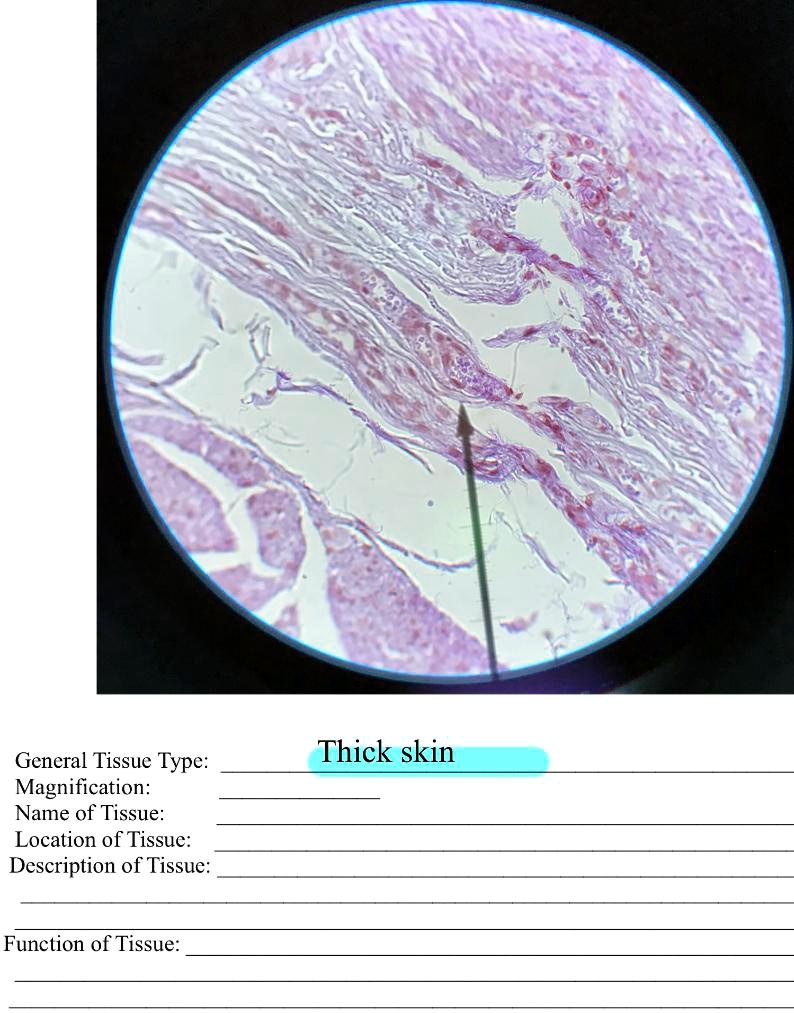 SOLVED: please correct me if the pictures and the tissue names are not ...