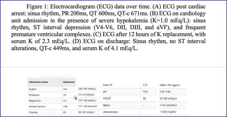 figure 1 electrocardiogram ecg data over time a ecg post cardiac arrest ...
