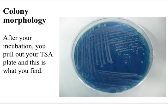 Colony morphology After your incubation, you pull out your TSA plate ...