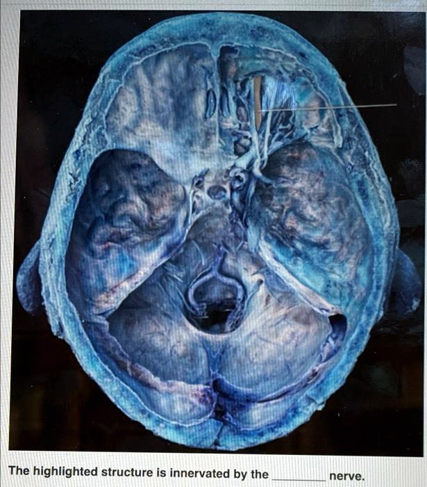 SOLVED: The highlighted structure is innervated by the nerve The highlighted structure is ...