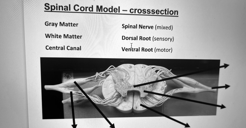 SOLVED: 'Spinal Cord Model crosssection Gray Matter Spinal Nerve (mixed ...