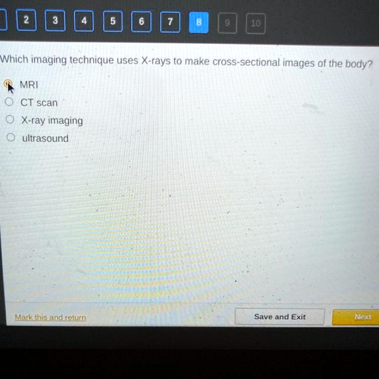 Which imaging technique uses X-rays to make cross-sectional images of ...