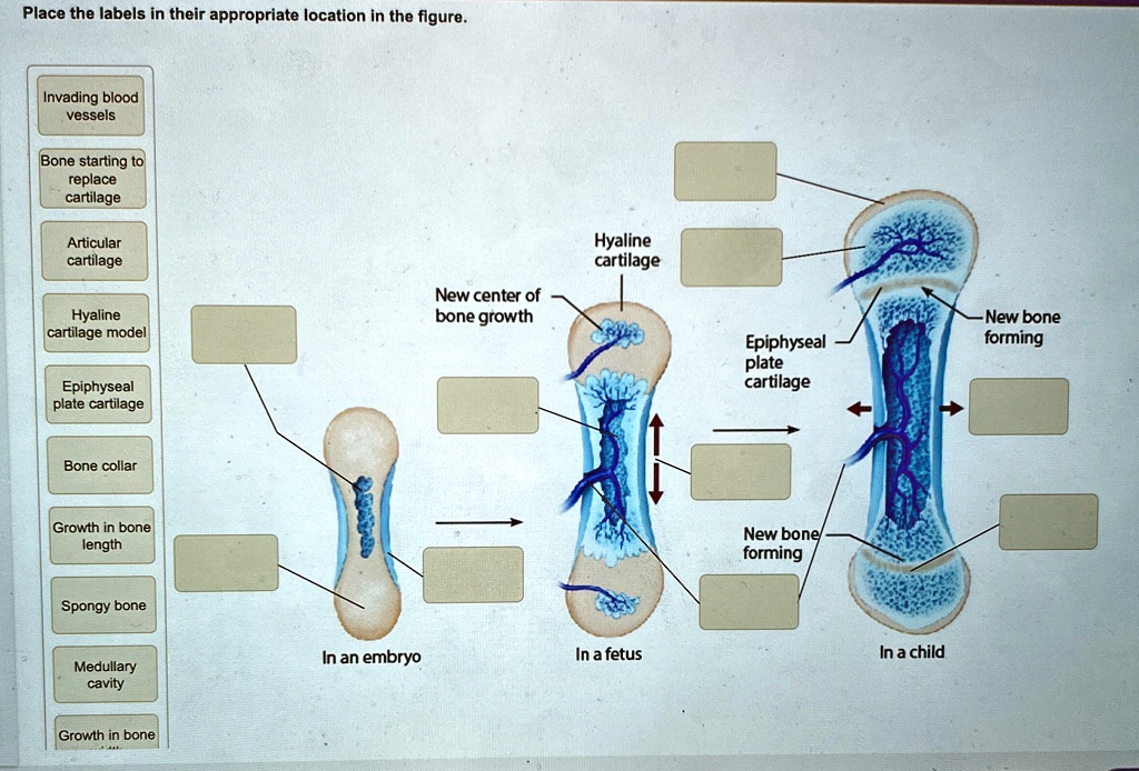 Place the labels in their appropriate location in the figure. Invading ...