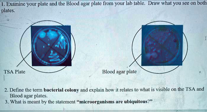 SOLVED: Examine your plate and the Blood agar plate from your lab table ...