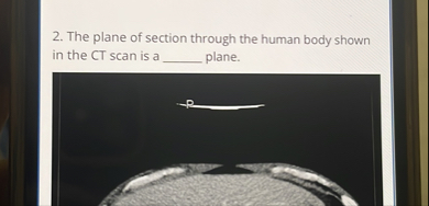 2. The plane of section through the human body shown in the CT scan is ...