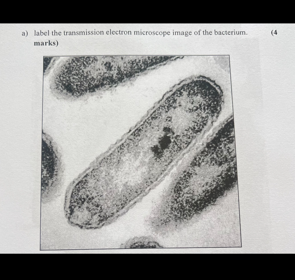 a) label the transmission electron microscope image of the bacterium ...