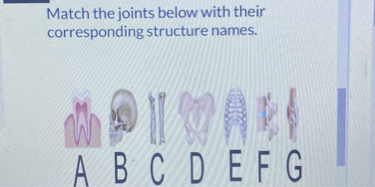 Match the joints below with their corresponding structure names.