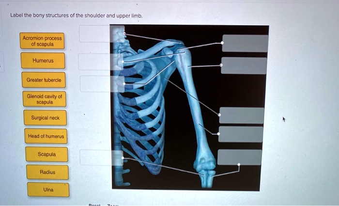 SOLVED: Label the bony structures of the shoulder and upper limb. Acromion process of scapula ...